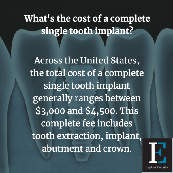 How much do dental implants really cost? | Implant Evolution