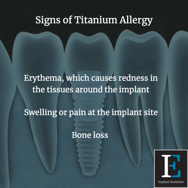 How do you know if your body is rejecting a dental implant? | Implant ...